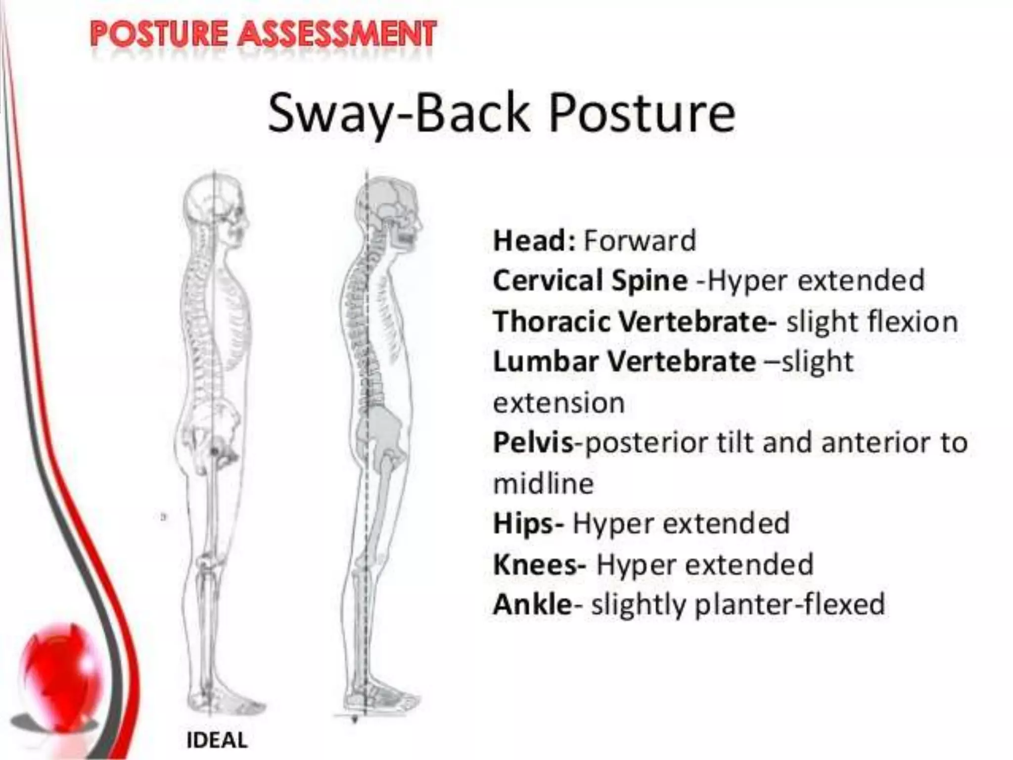 Postural deviations of spine by Dr. Nidhi | PPTX