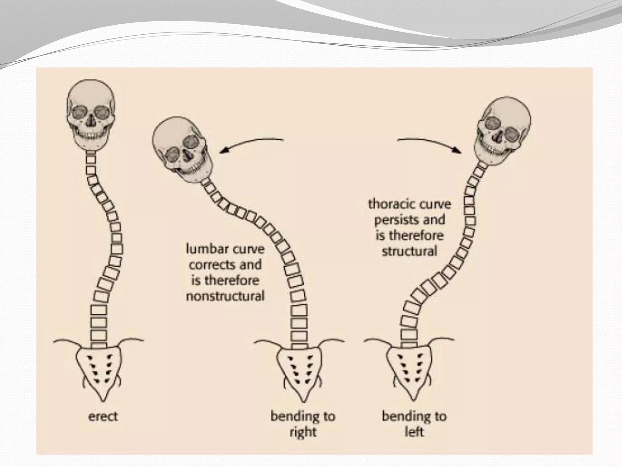 Postural deviations of spine by Dr. Nidhi | PPTX