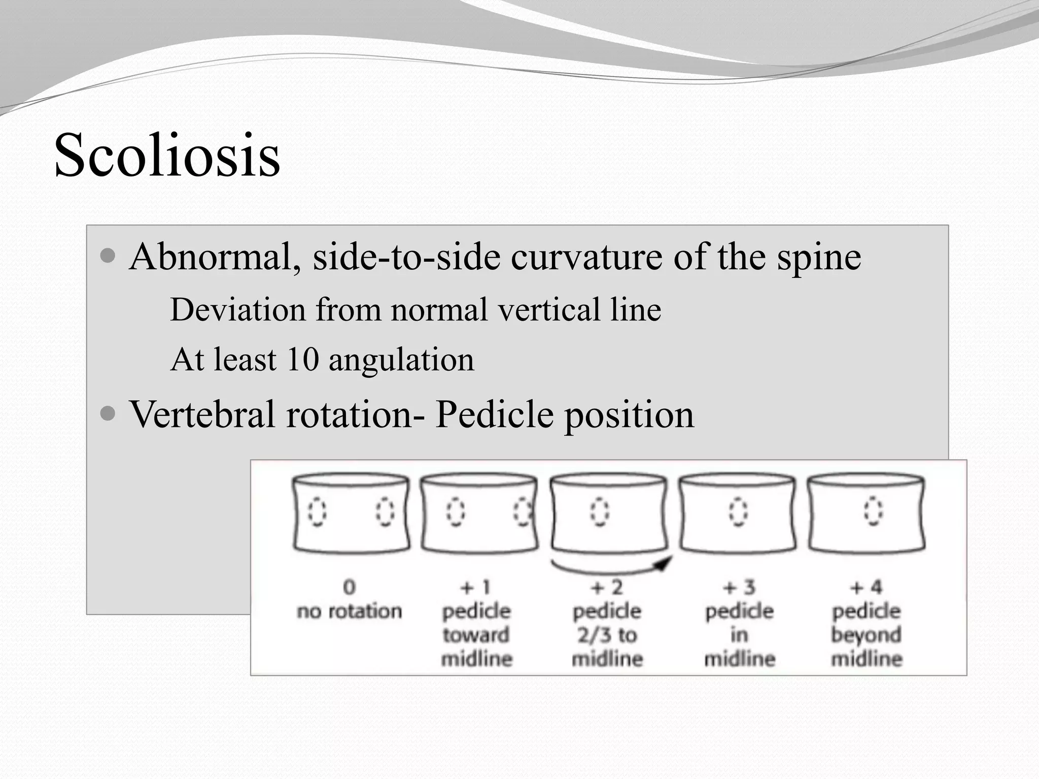 Postural deviations of spine by Dr. Nidhi | PPTX