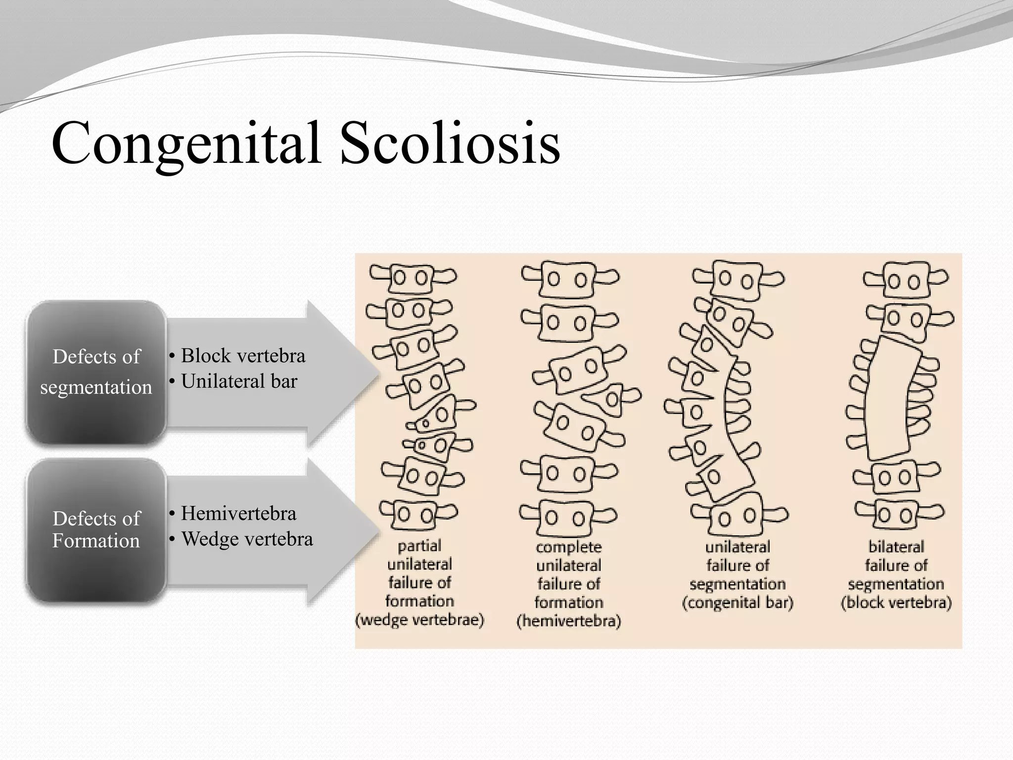Postural deviations of spine by Dr. Nidhi | PPTX