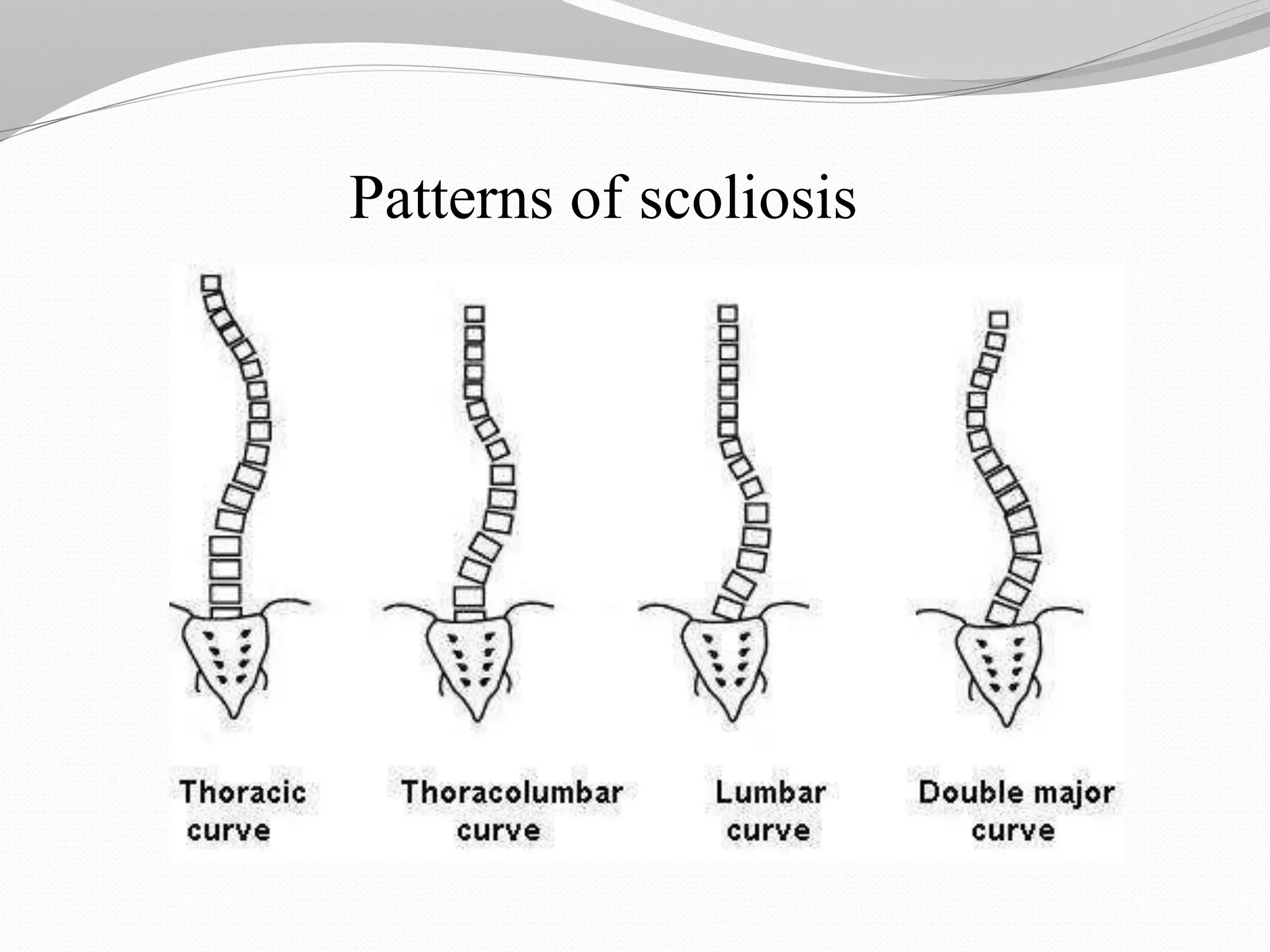 Postural deviations of spine by Dr. Nidhi | PPTX