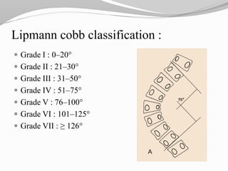 Postural deviations of spine by Dr. Nidhi | PPT