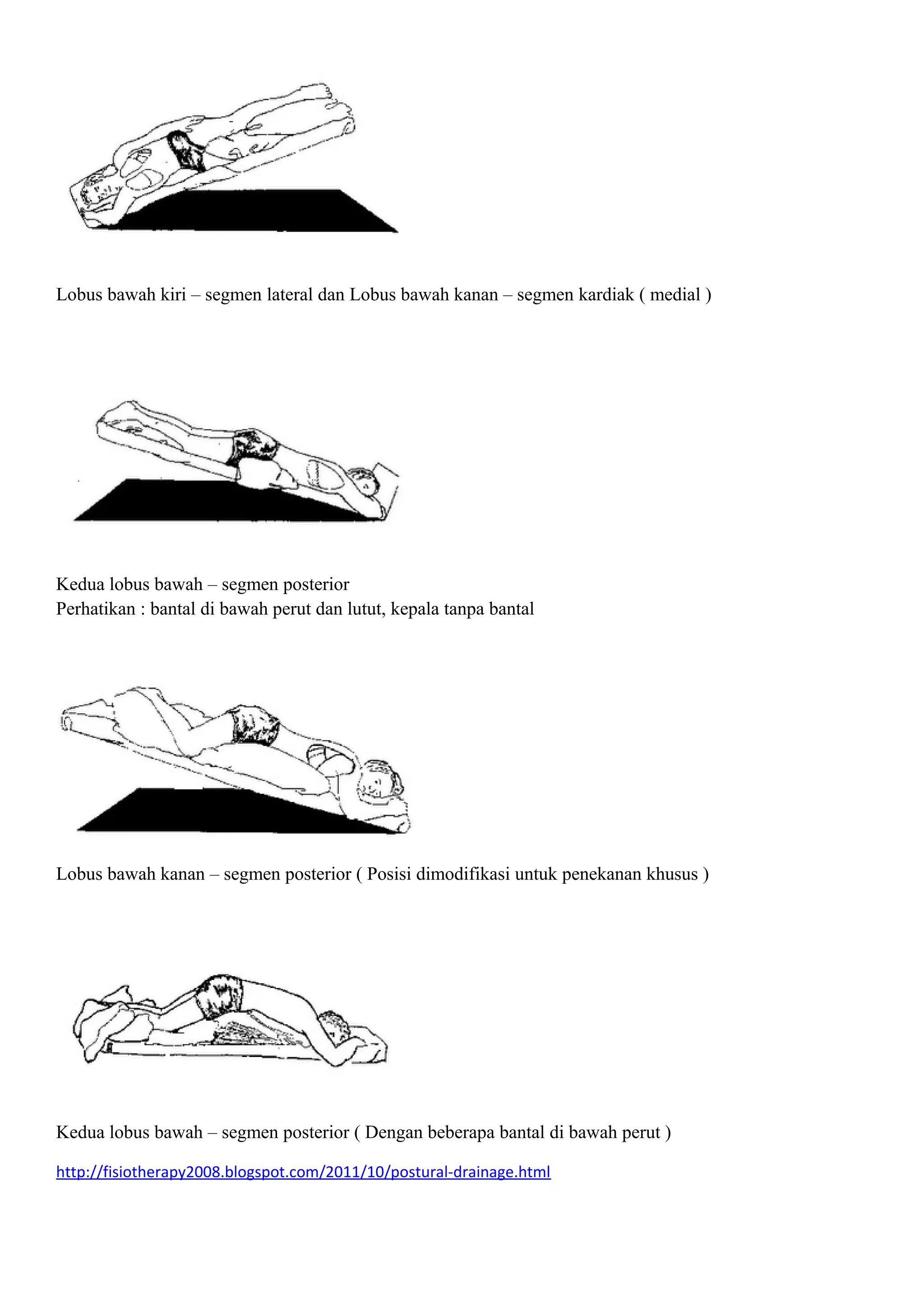 Postural drainage | DOC