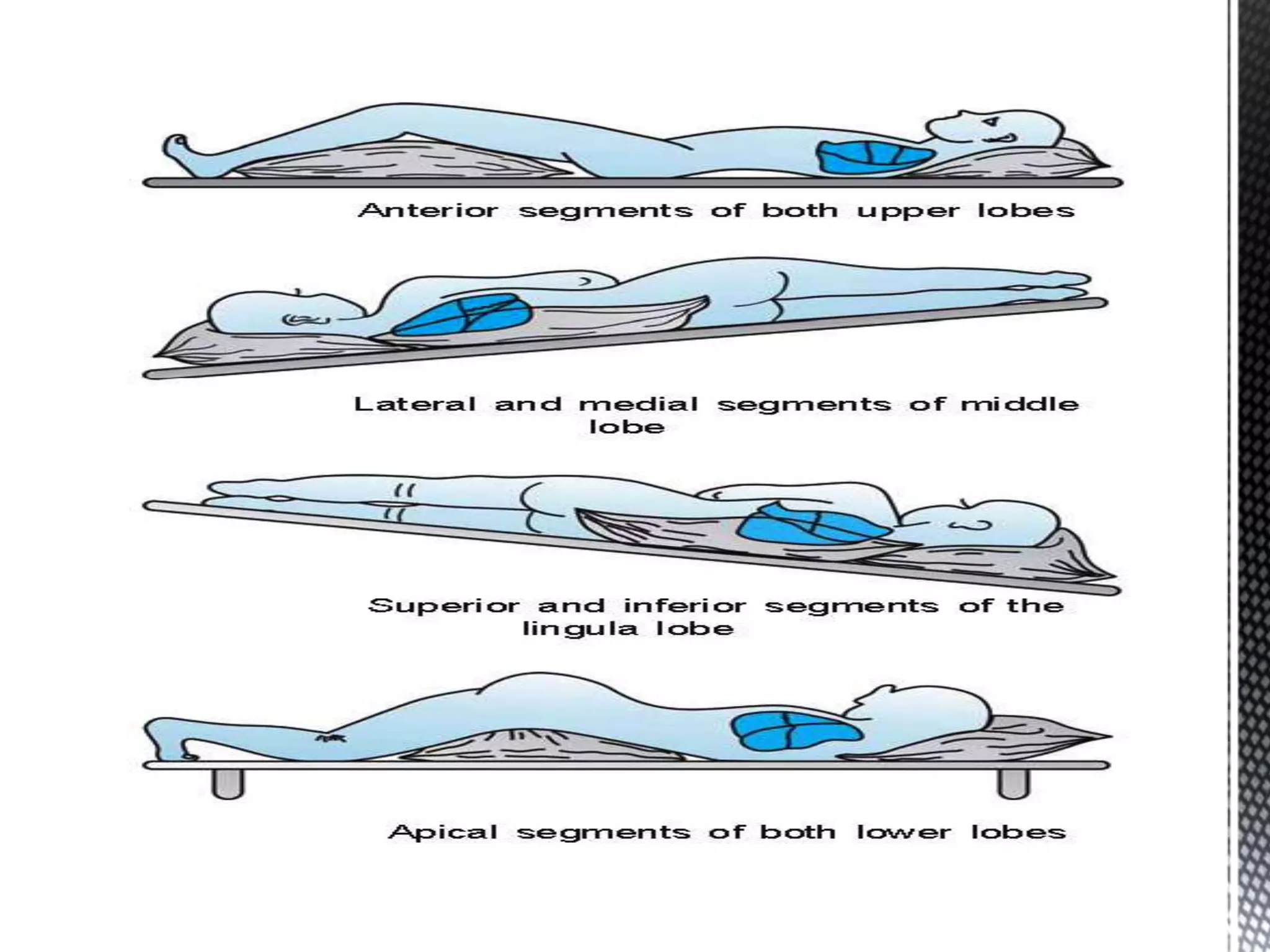 Postural drainage | PPTX
