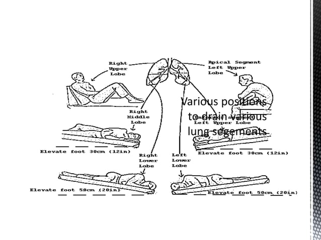 Postural drainage | PPTX