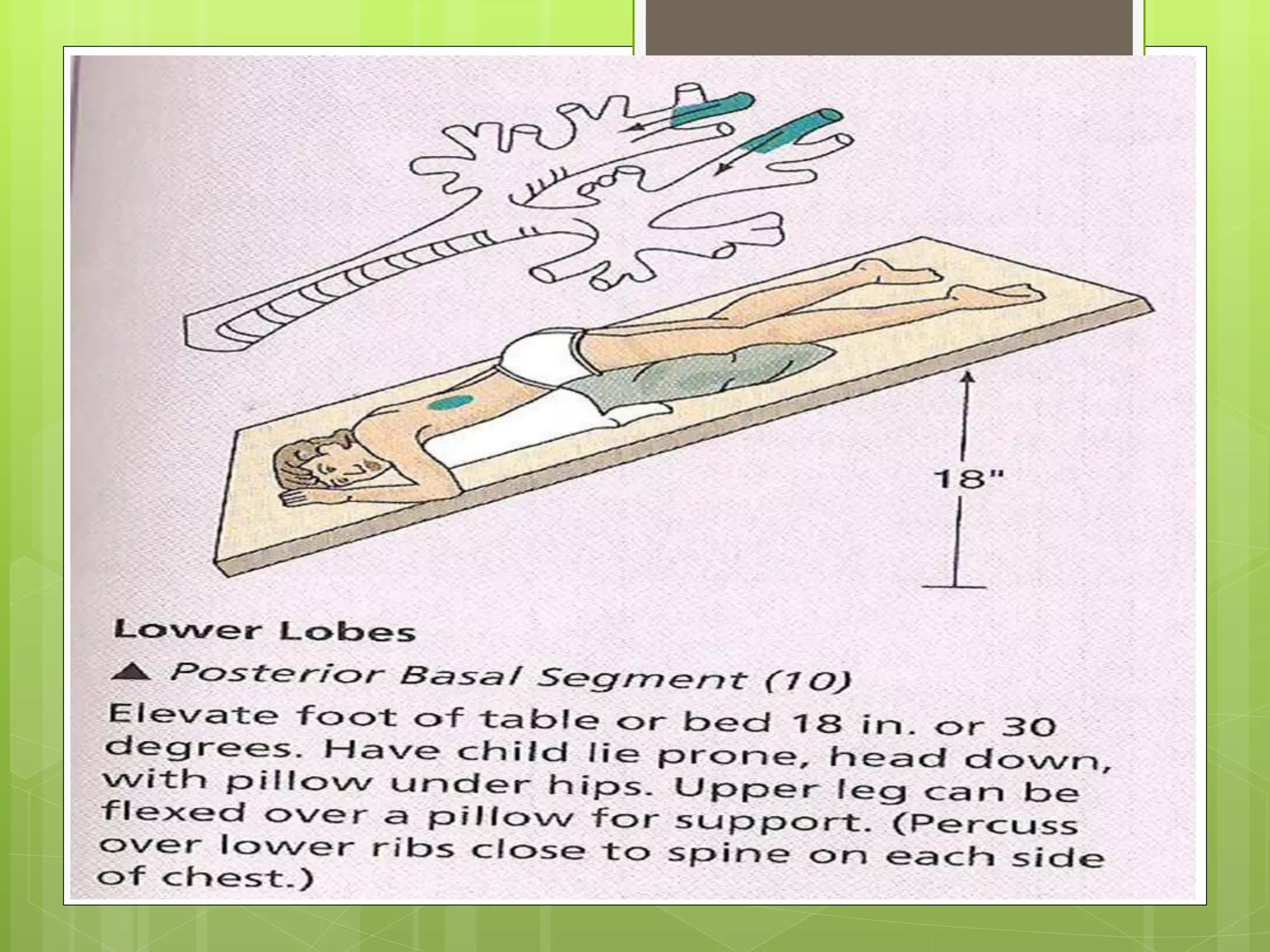 Postural drainage | PPTX