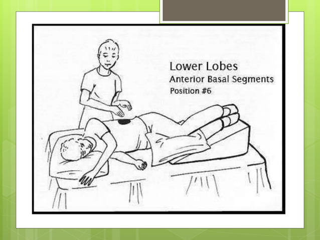 Postural drainage | PPTX | Lung and Respiratory Health | Diseases and ...