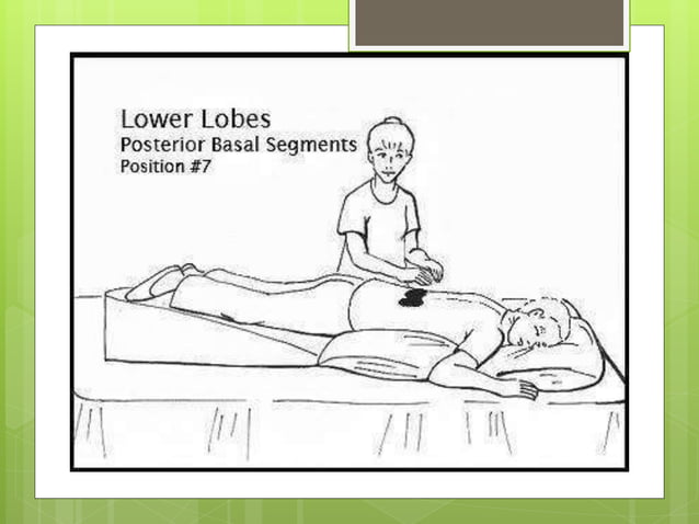 Postural drainage | PPTX | Lung and Respiratory Health | Diseases and ...