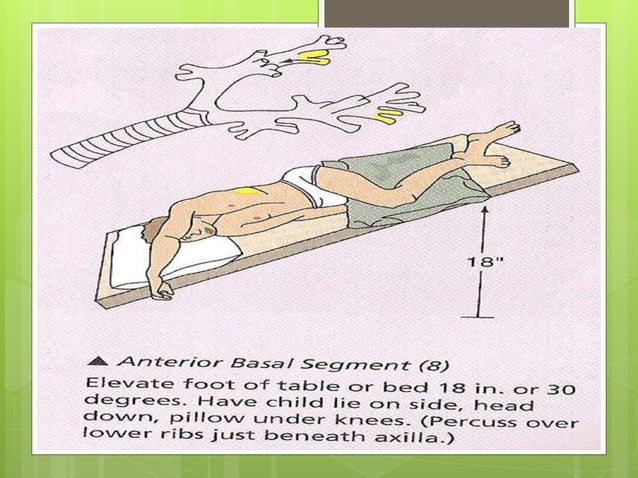 Postural drainage | PPTX | Lung and Respiratory Health | Diseases and ...