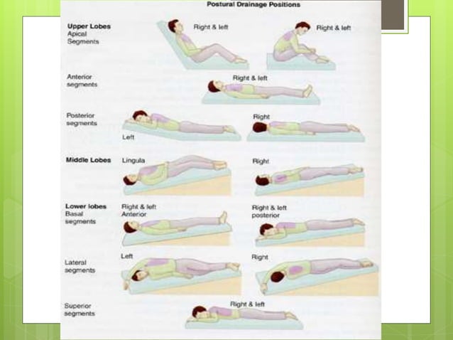 Postural drainage | PPTX | Lung and Respiratory Health | Diseases and ...