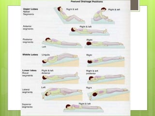 Postural Drainage Positions Pdf