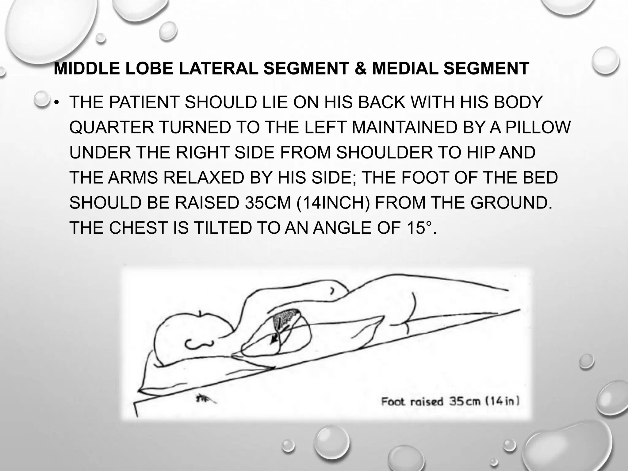 Postural drainage (PD) | PPTX