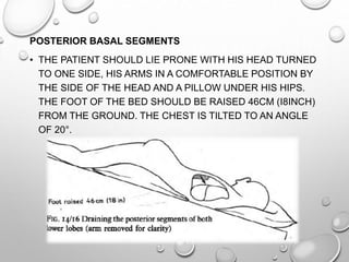Postural drainage (PD) | PPTX