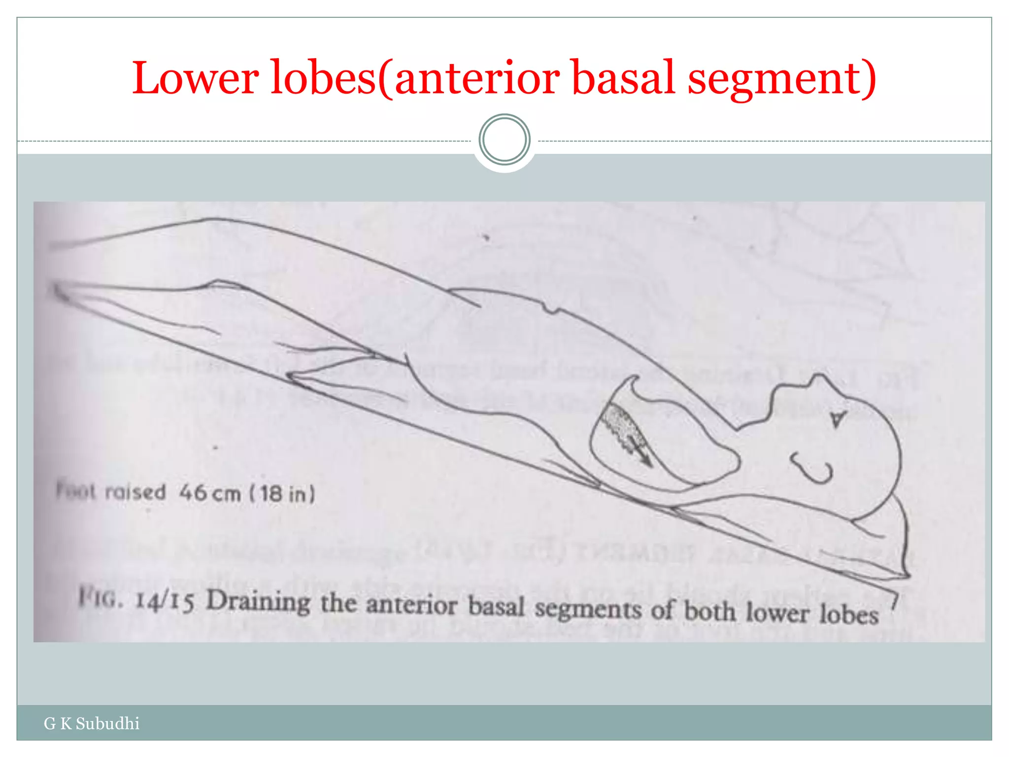 Postural drainage | PDF