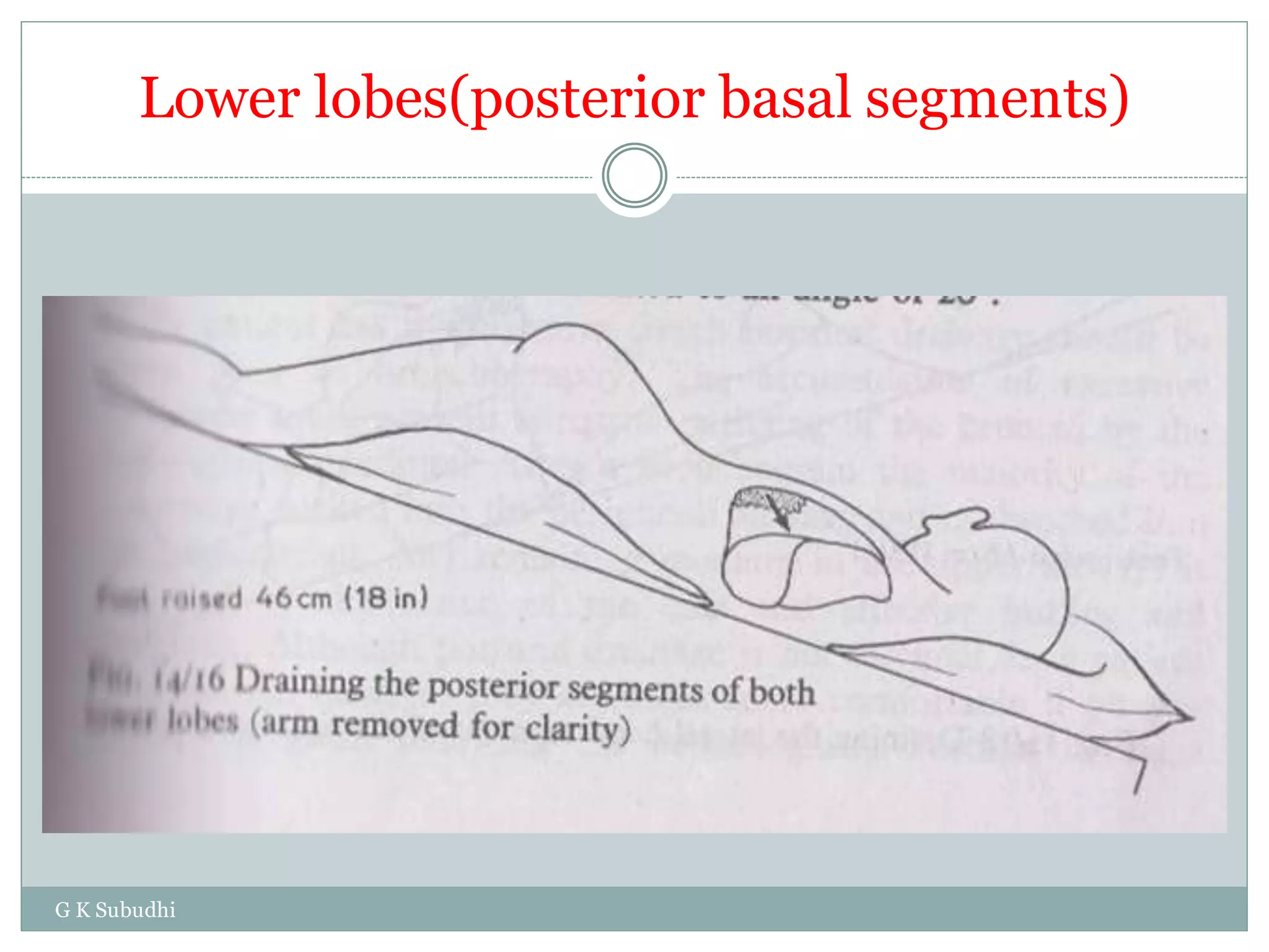 Postural drainage | PDF
