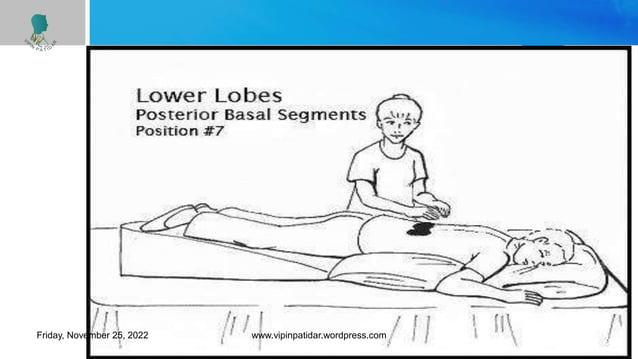 postural drainage | PPTX