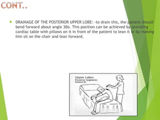 POSTURAL DRAINAGE PROCEDURE IN NURSING CARE | PPT