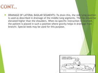 POSTURAL DRAINAGE PROCEDURE IN NURSING CARE | PPT