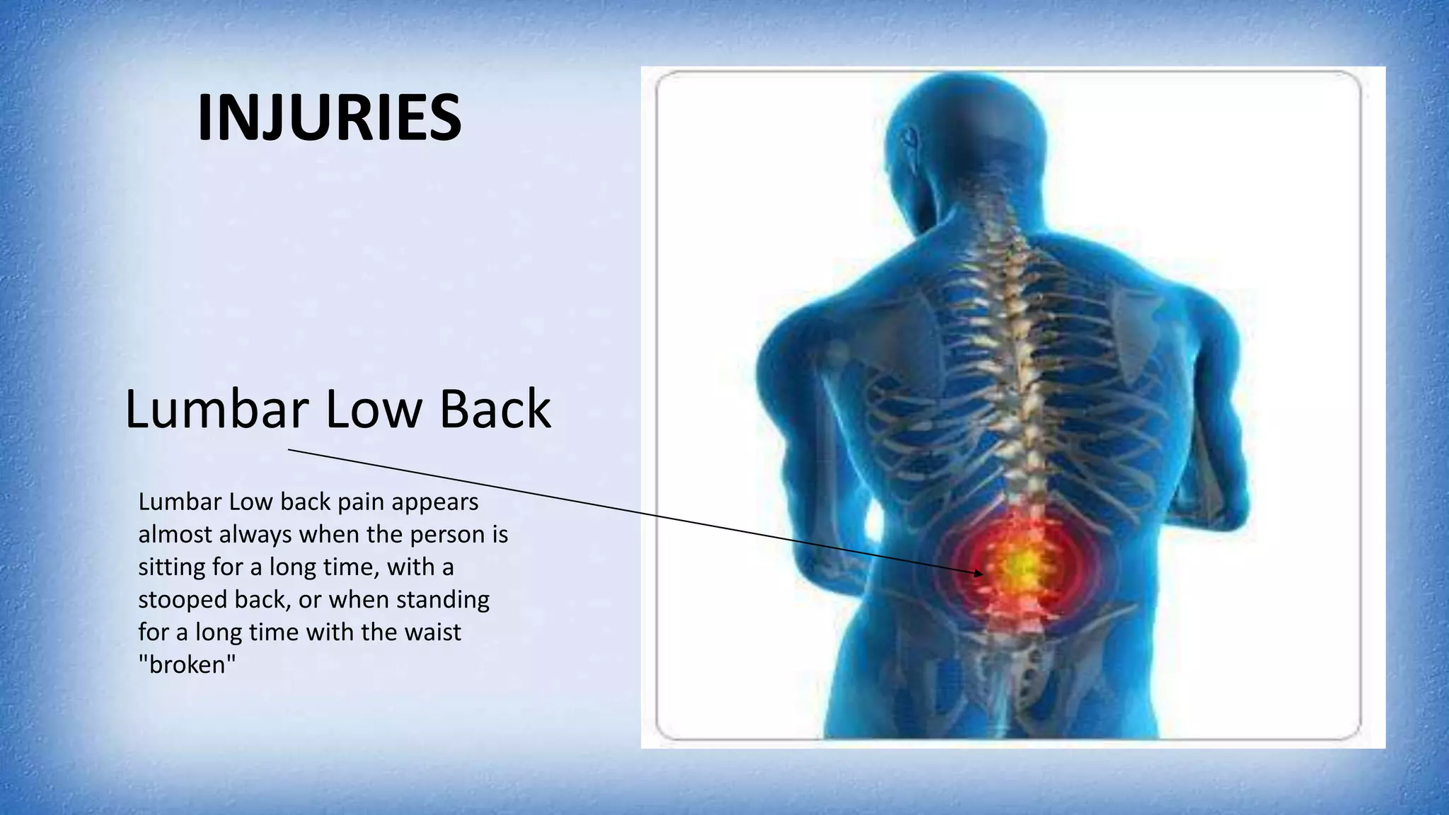 Postural hygiene | PPTX