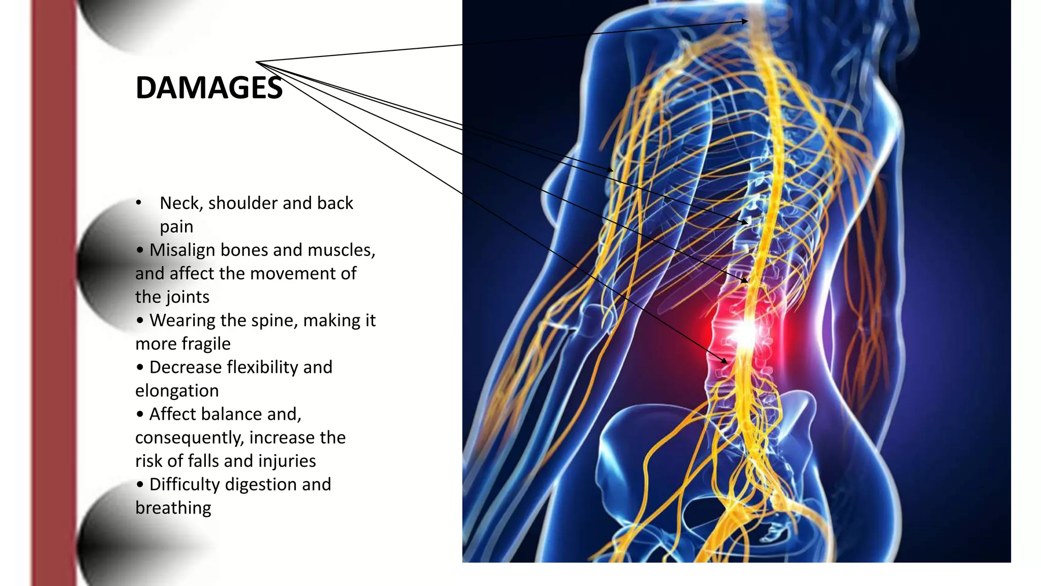 Postural hygiene | PPTX