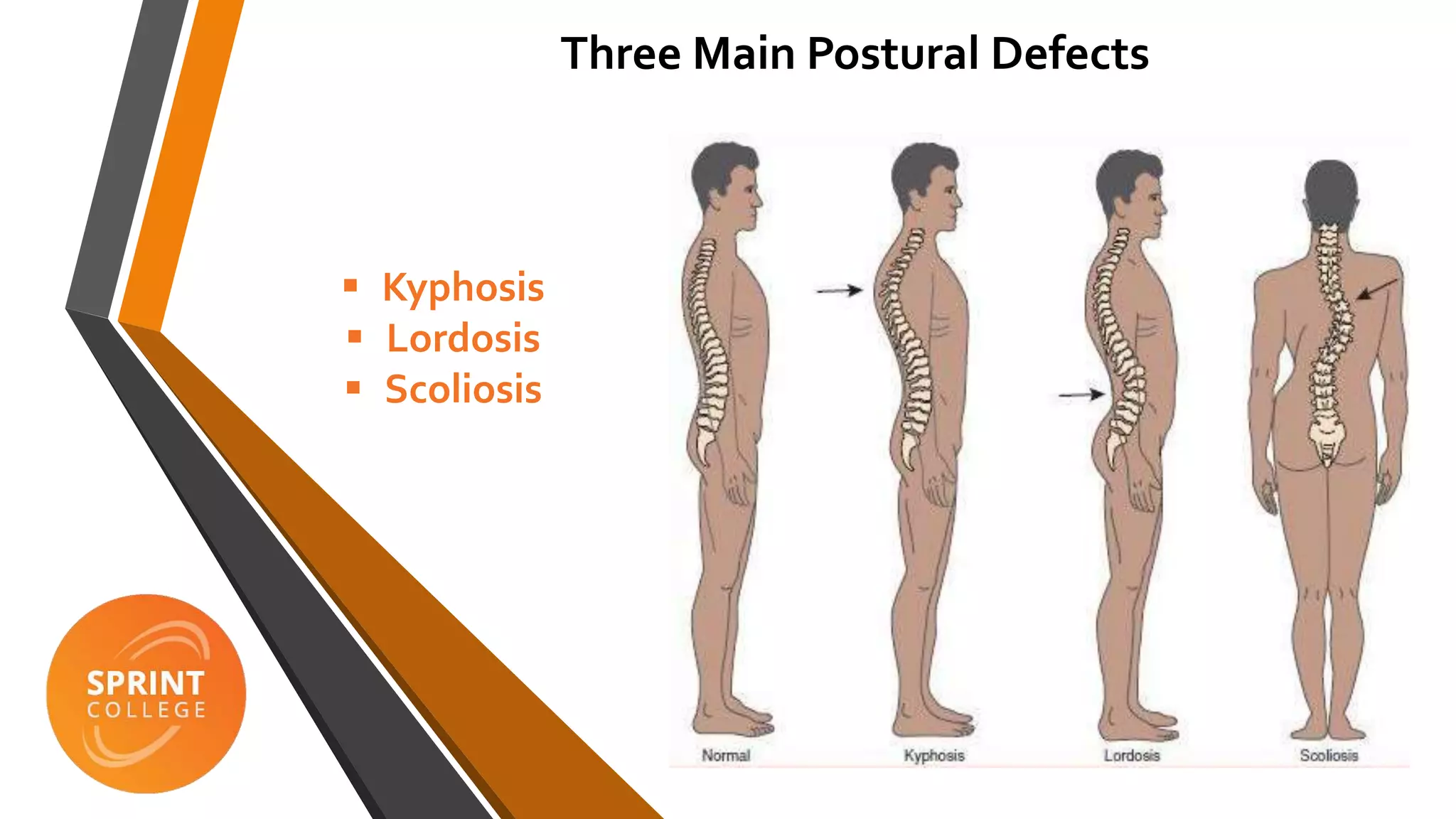 Postural Issues and Body Types | PPTX