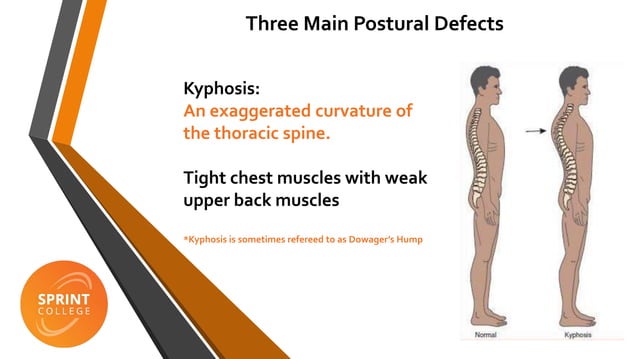 Postural Issues and Body Types | PPT