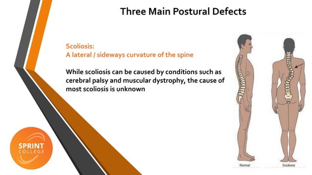 Postural Issues and Body Types | PPT