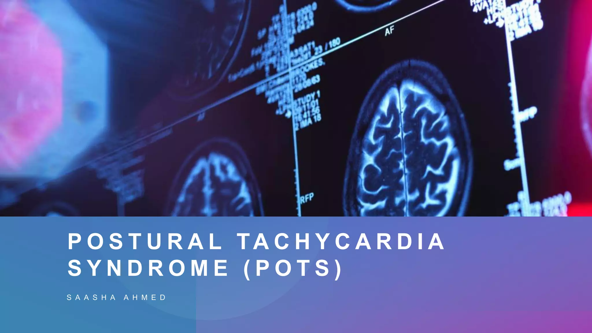Postural tachycardia syndrome (pots) | PPTX