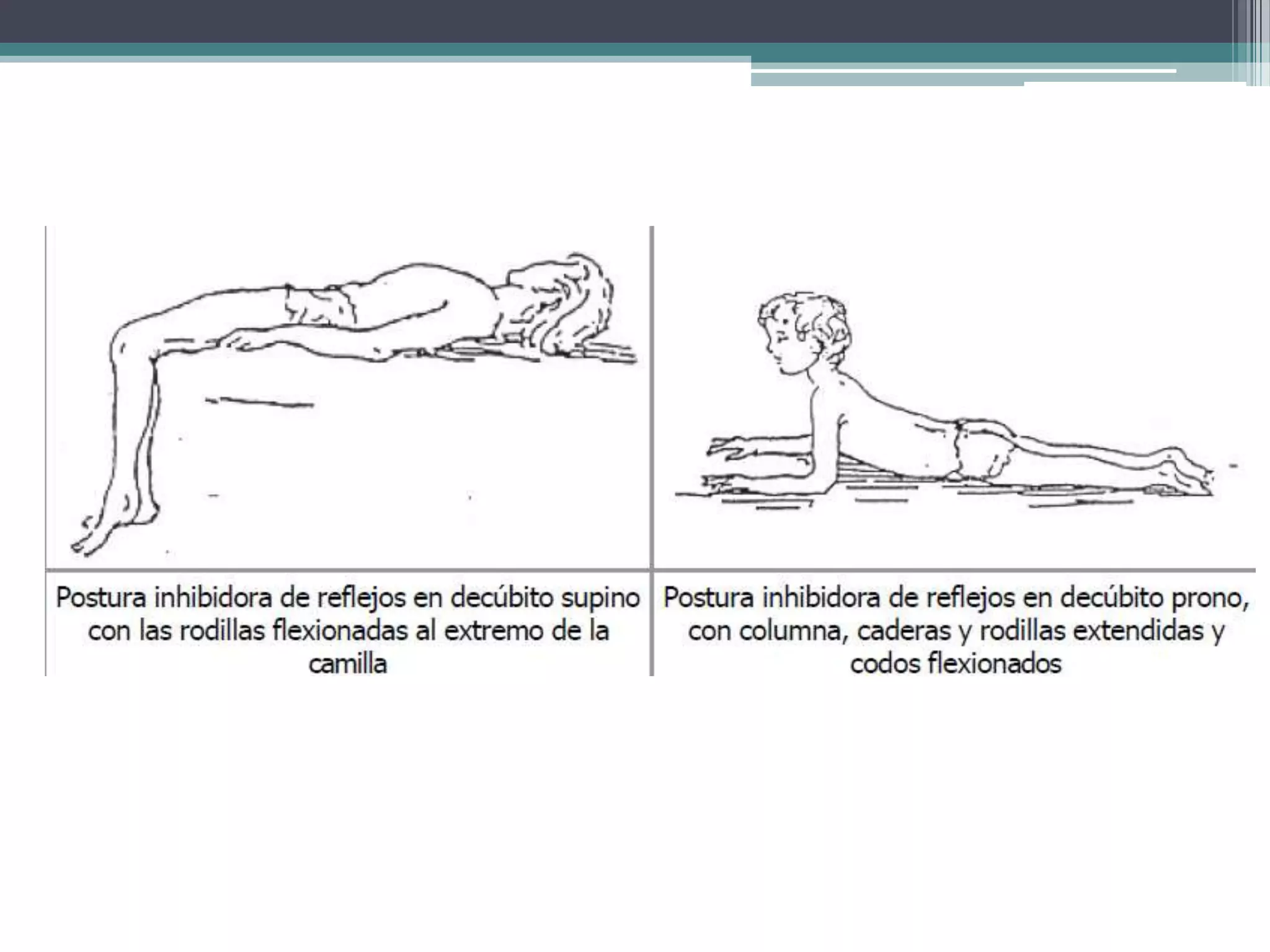 Posturas inhibitorias de reflejos patológicos. | PPTX