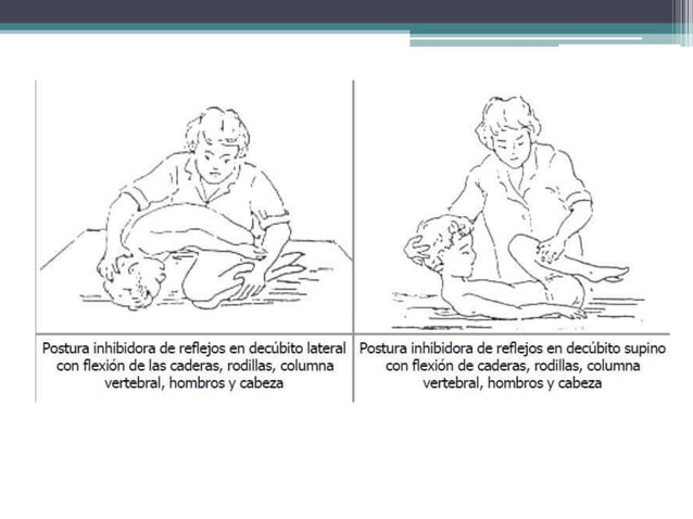 Posturas inhibitorias de reflejos patológicos. | PPTX