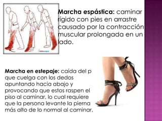 Postura y marcha | PPTX