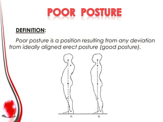 Posture | PPTX