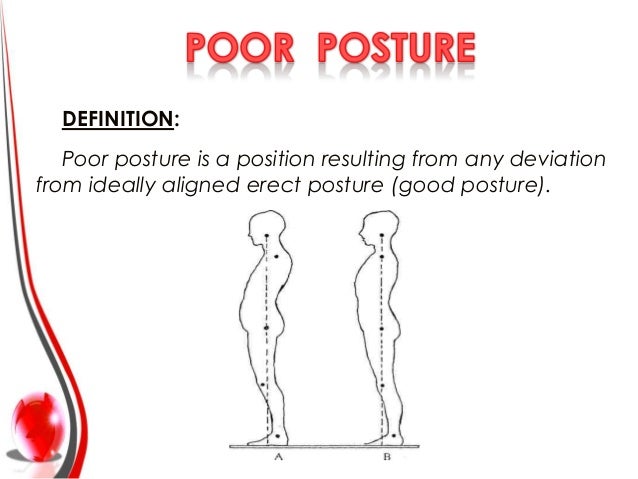 Posture
