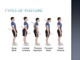 Posture | PPTX