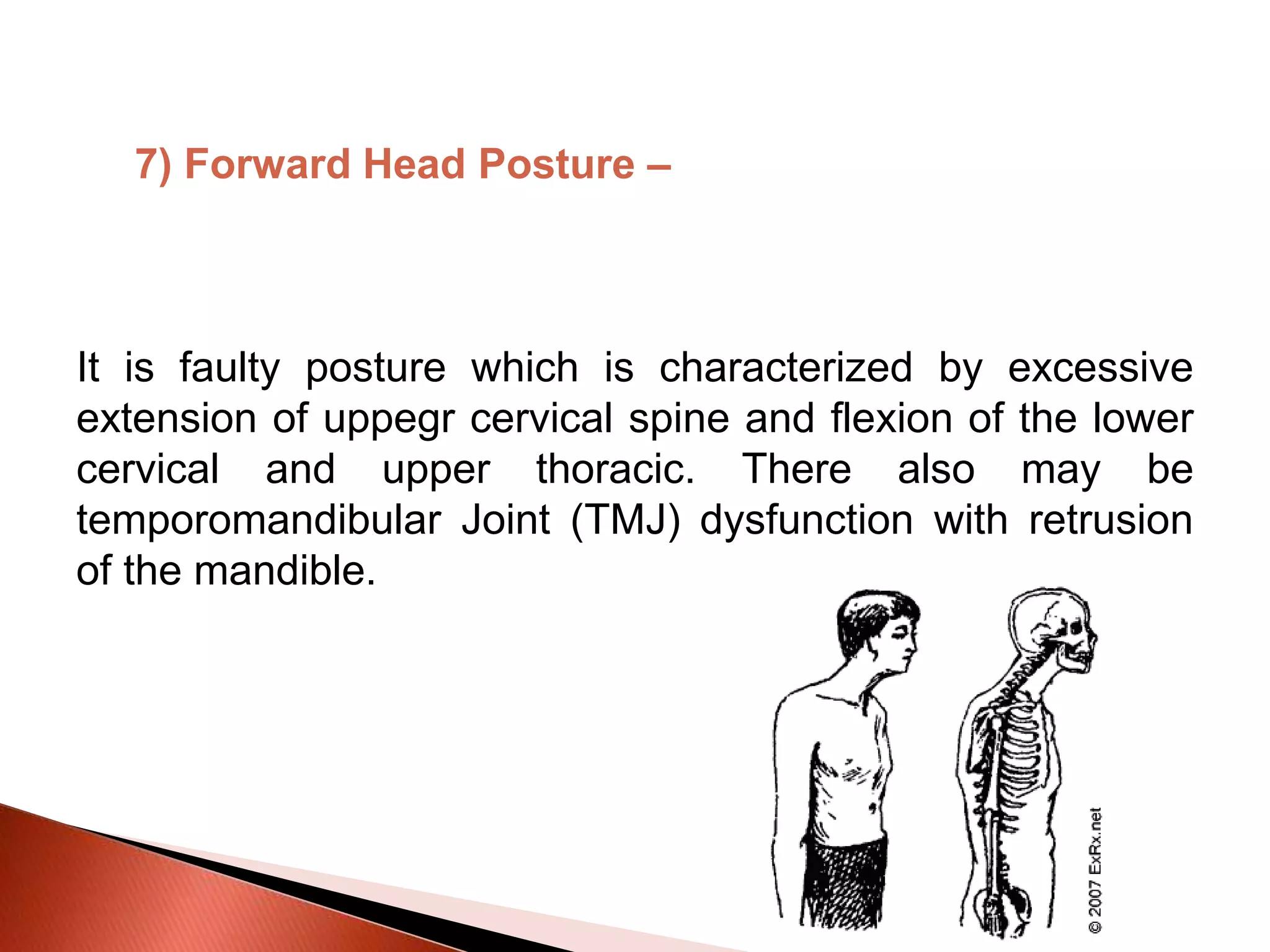 Posture | PPTX