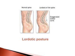 Posture | PPTX