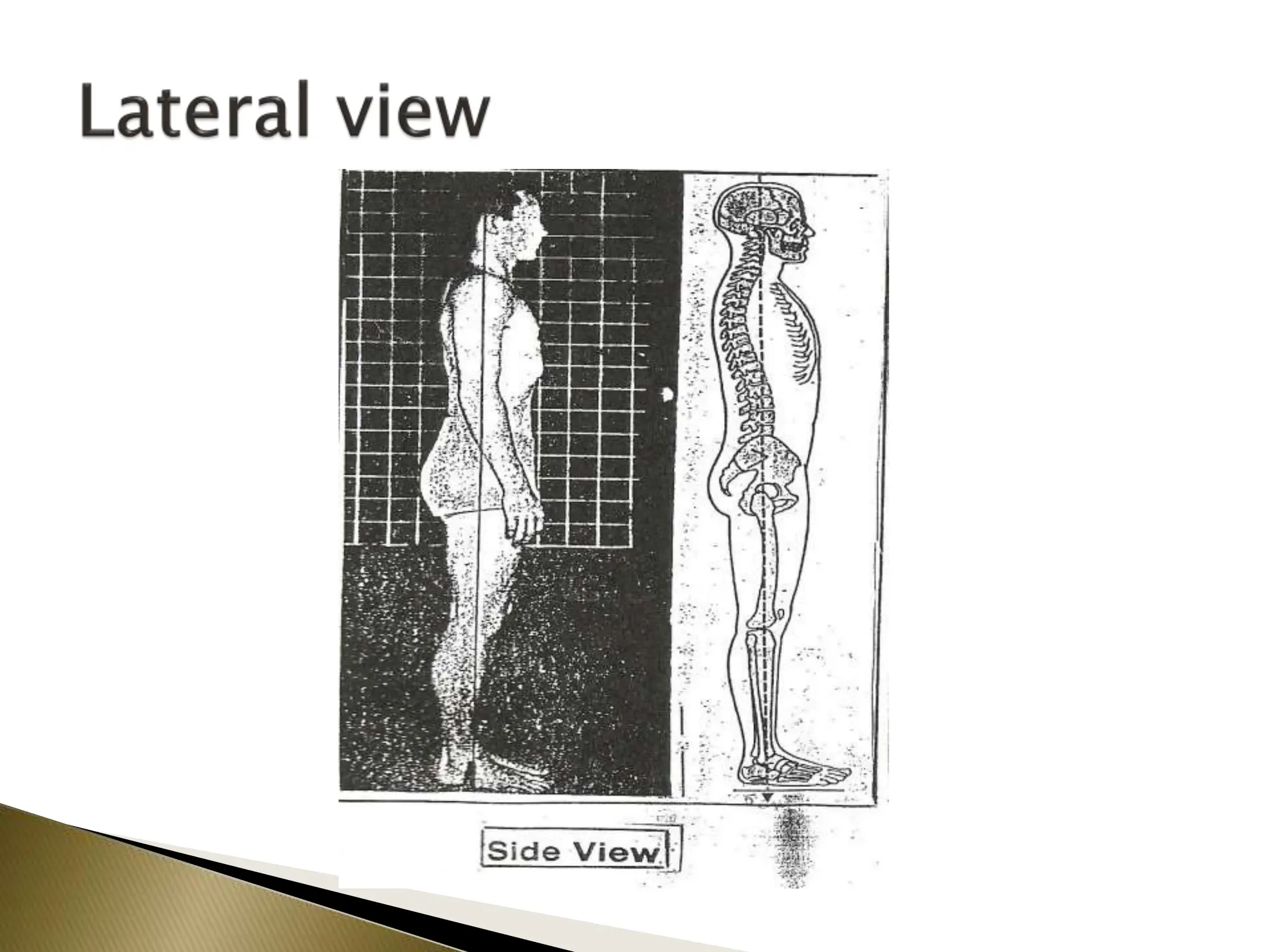 posture-biomechanics, kinetic and kinematics of posture, postural analysis | PDF