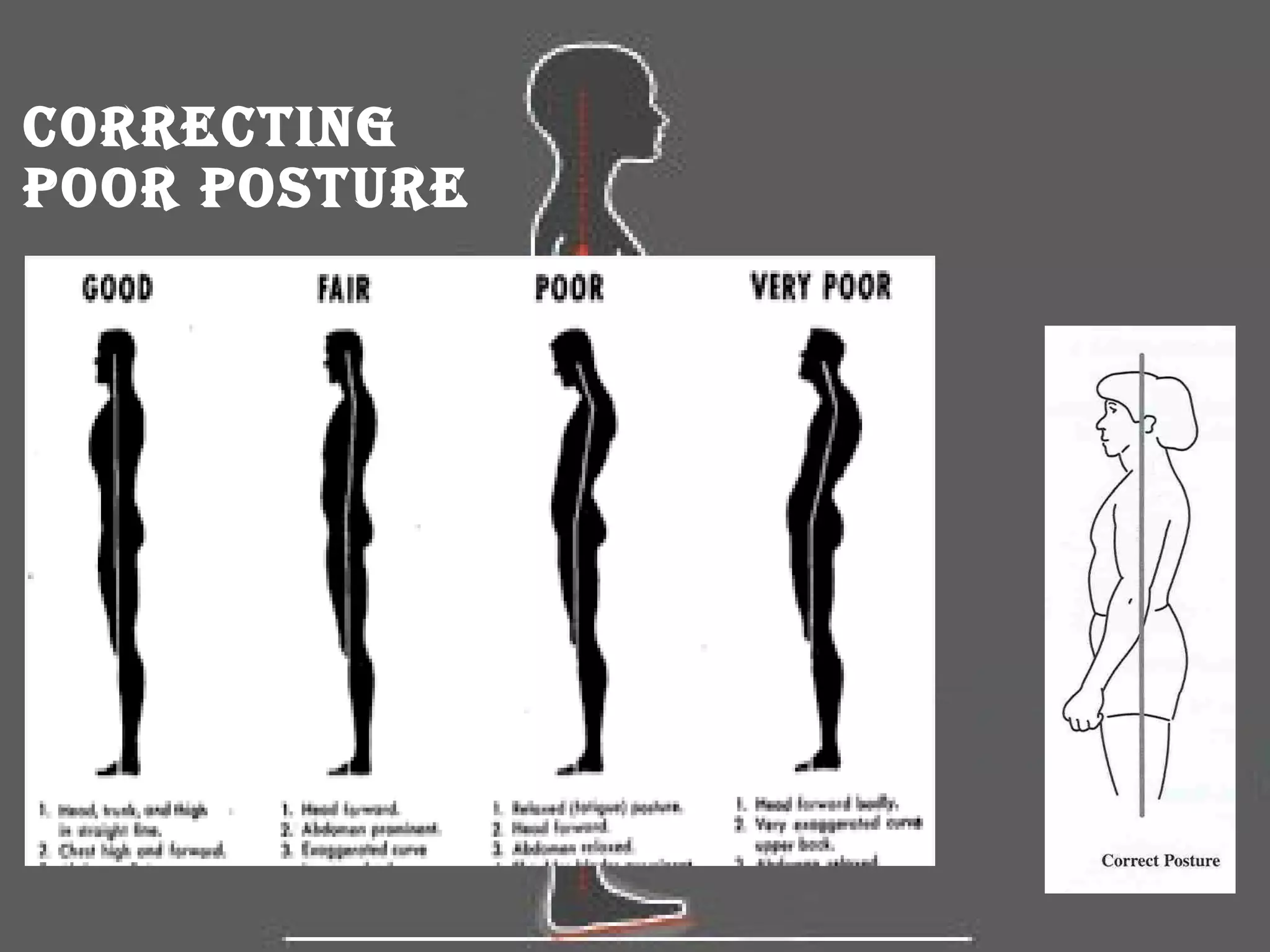 Posture management techniques | PPT