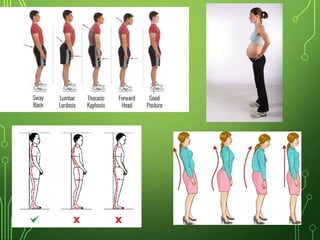 Posture | PPT