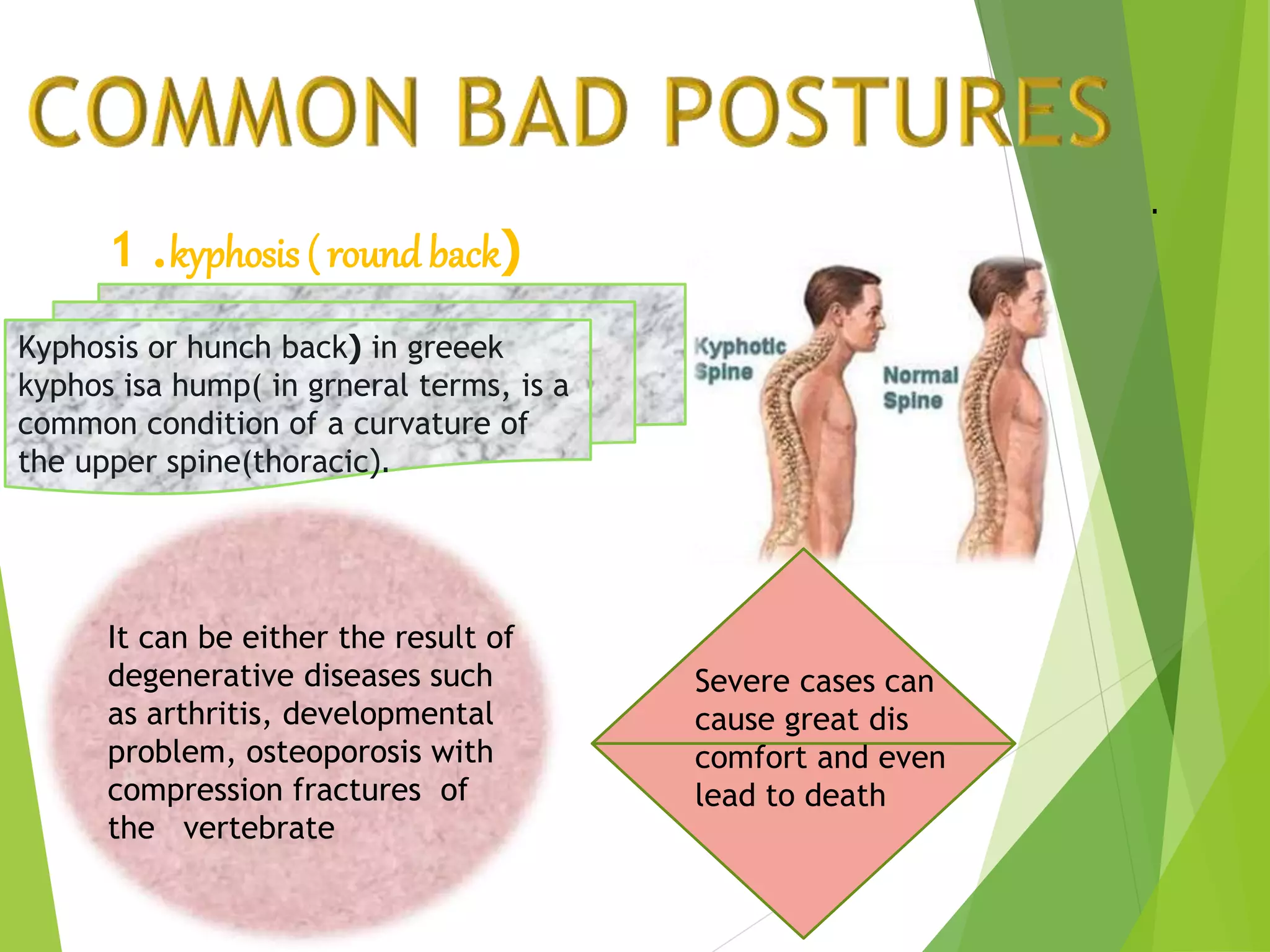 Posture and different bad postures | PPT