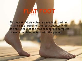 Posture and different bad postures | PPT