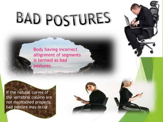 Posture and different bad postures | PPT