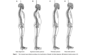 Posture | PPTX