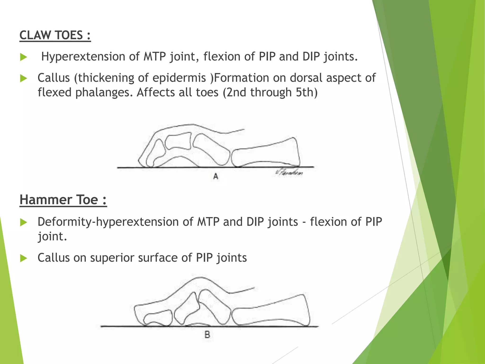 Biomechanics of Posture | PPTX