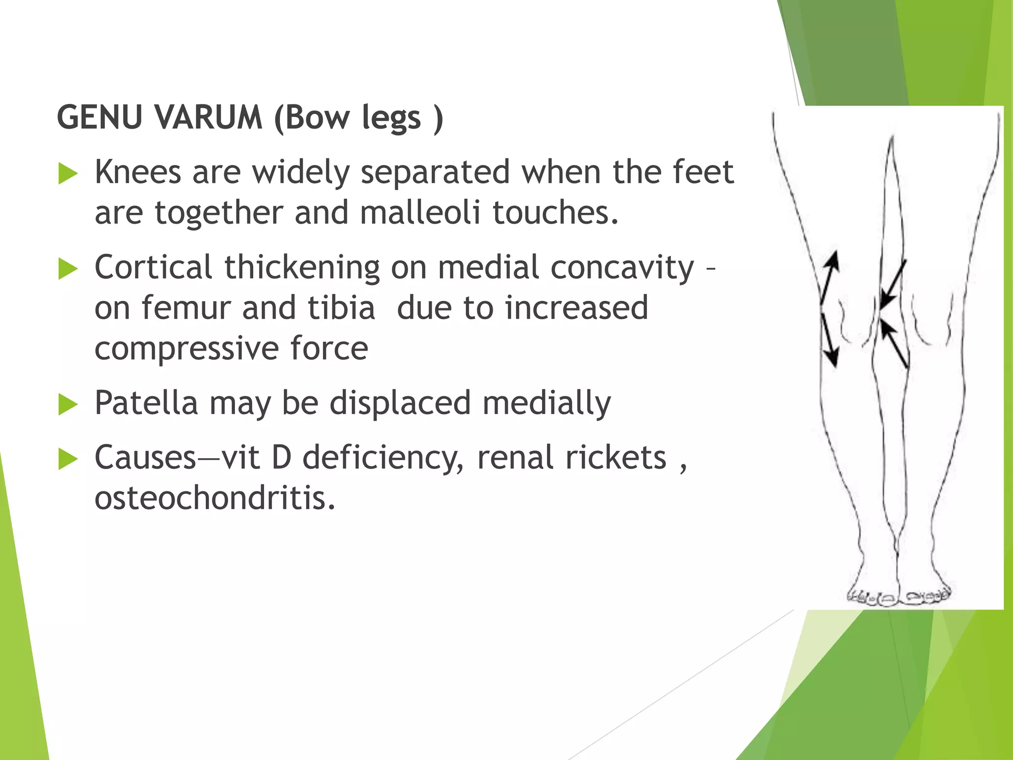 Biomechanics of Posture | PPTX