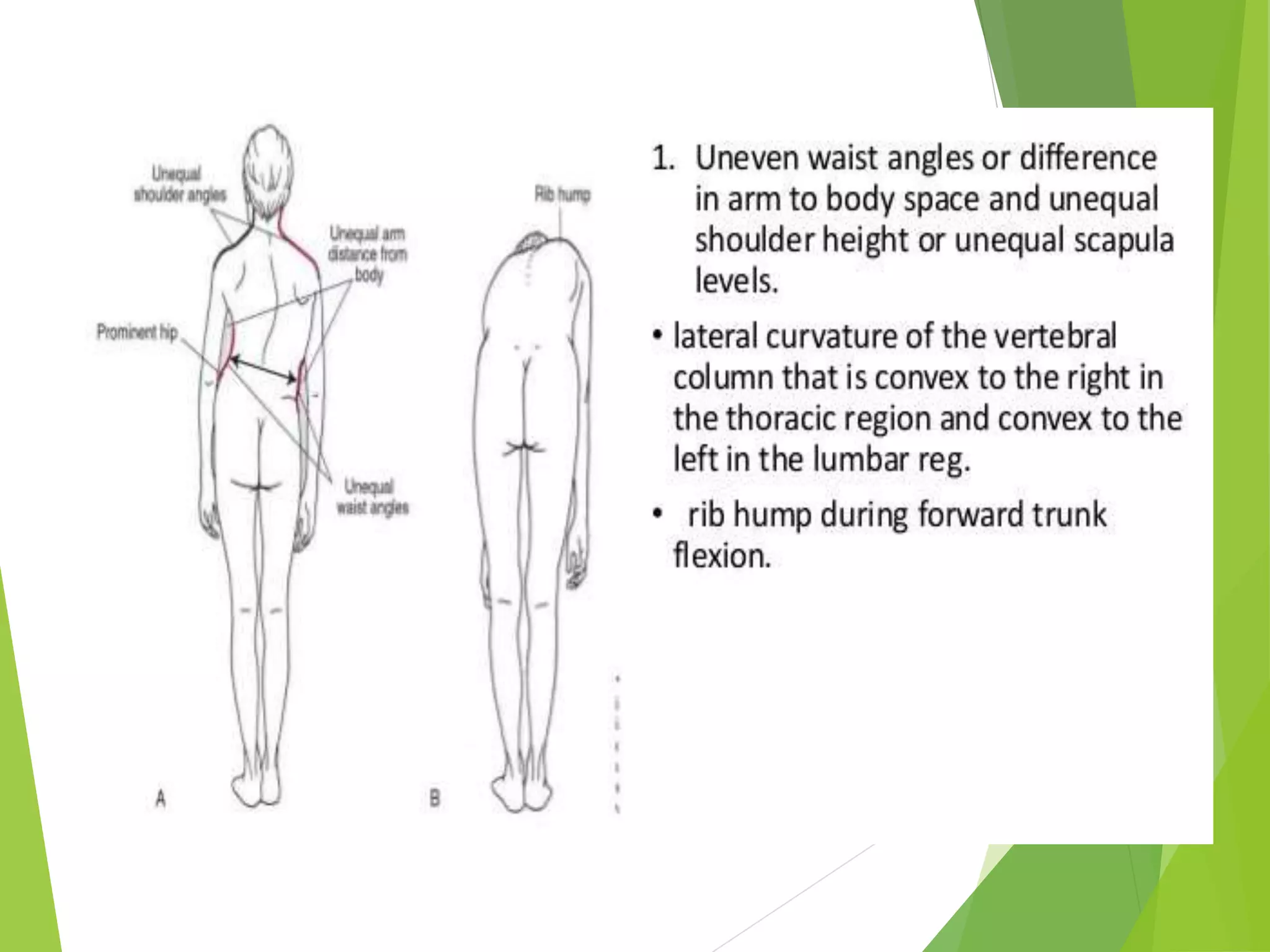 Biomechanics of Posture | PPTX