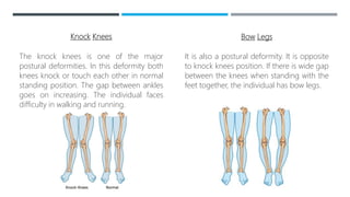Posture | PPTX