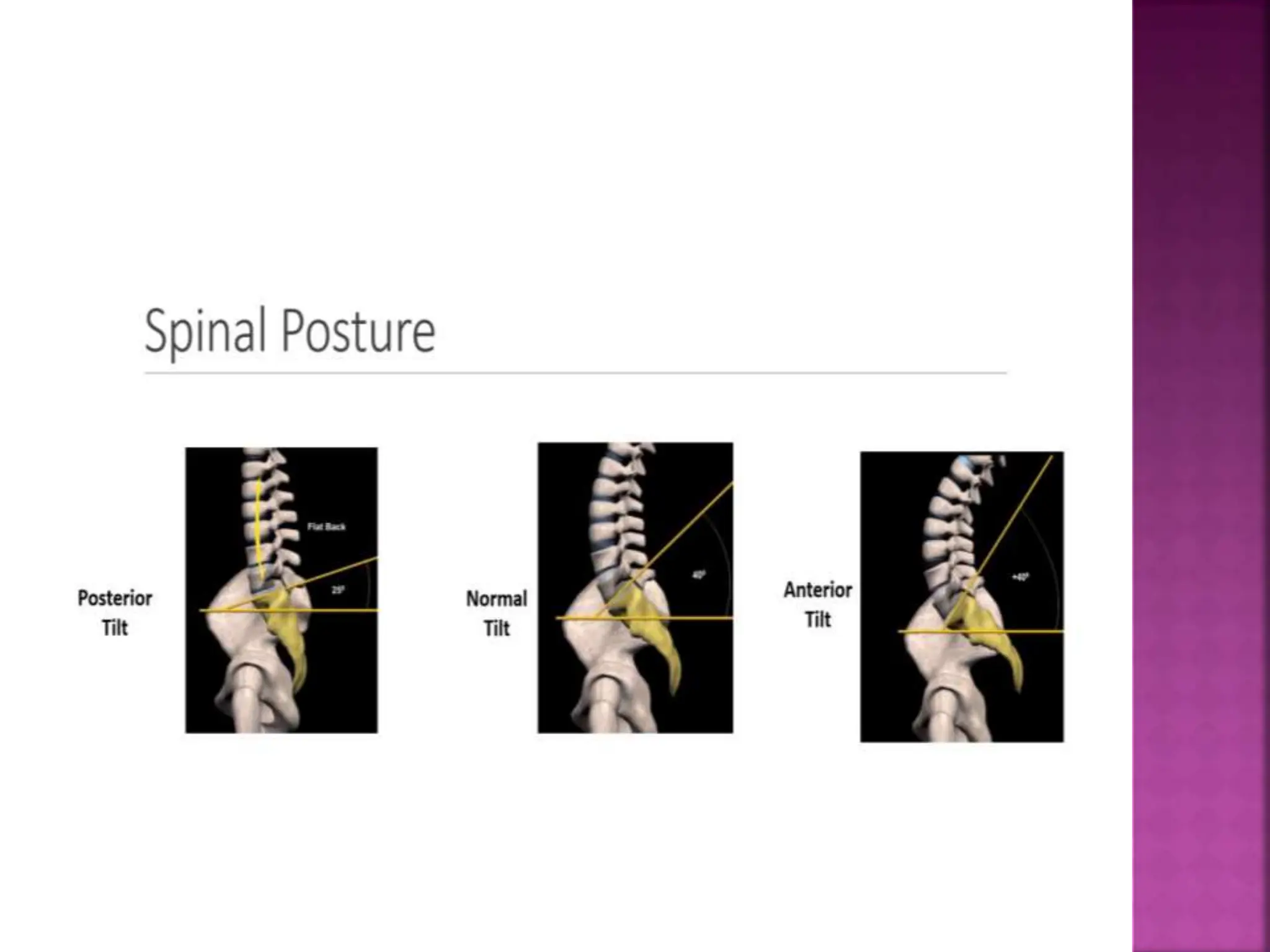 Posture analysis for physical therapists.pptx
