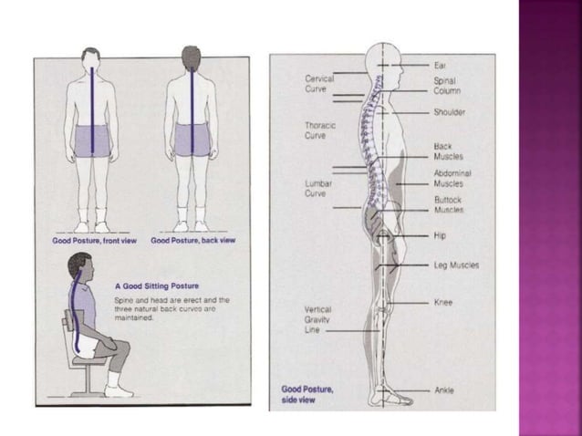 Posture analysis for physical therapists.pptx | Death, Injury, or ...