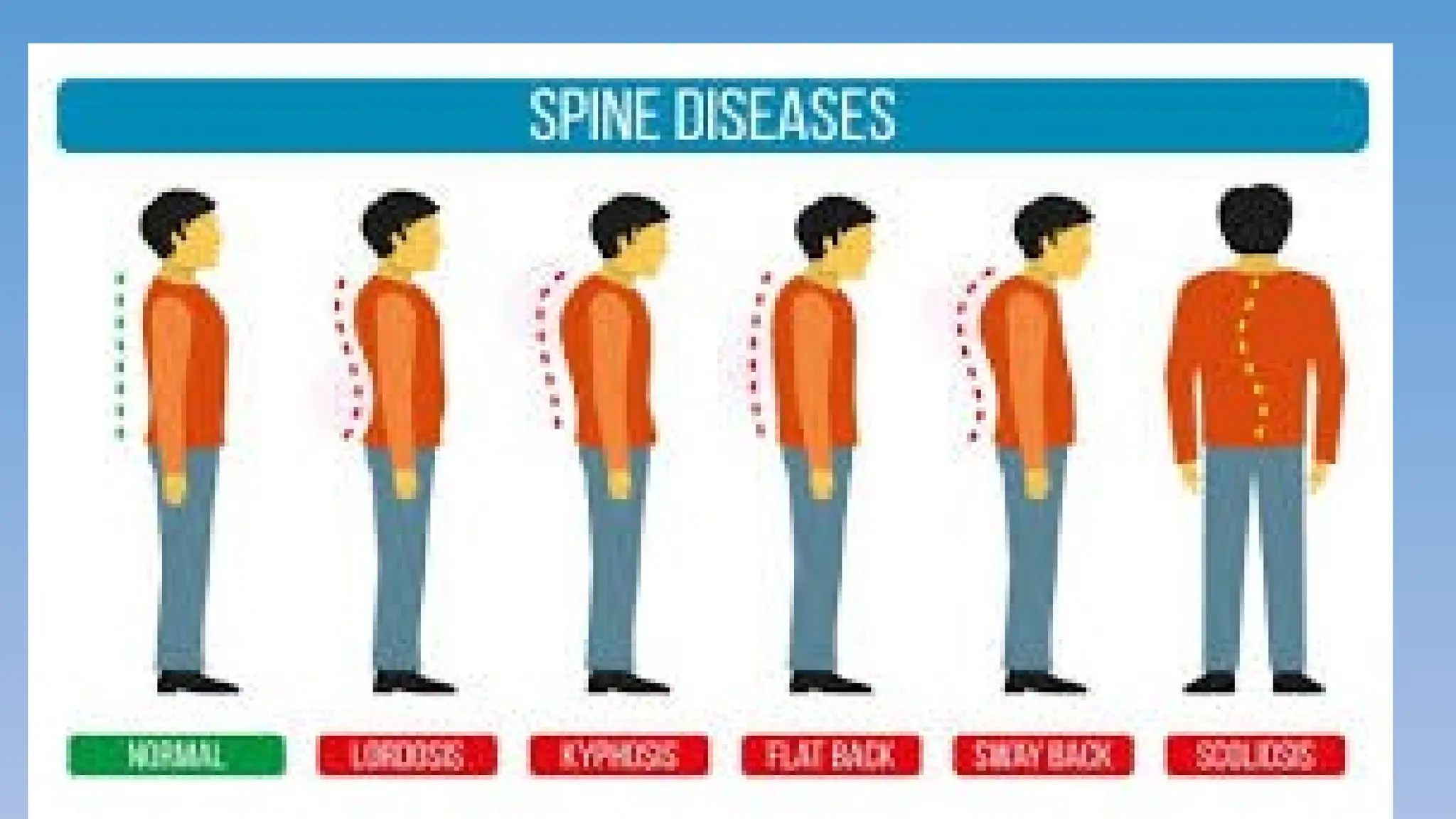 POSTURE.pptxiighhhhgghhgffghuuhggttdfggh | PPT